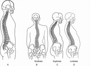 Normal Spine Architecture - Sankalp Spine Hospital